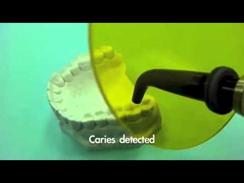 Direct Dental. Ledex LED Curing Light and Caries Detector Dentmate
